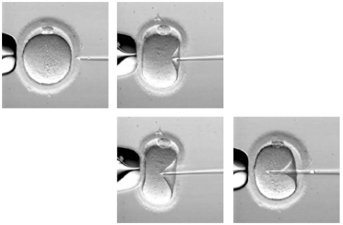 La Procréation Médicalement Assistée - Le blog SVT de M. KLAINGUER