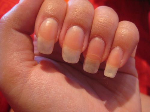 Ratiboisage, ou comment avoir l'impression d'avoir des moignons à la ...